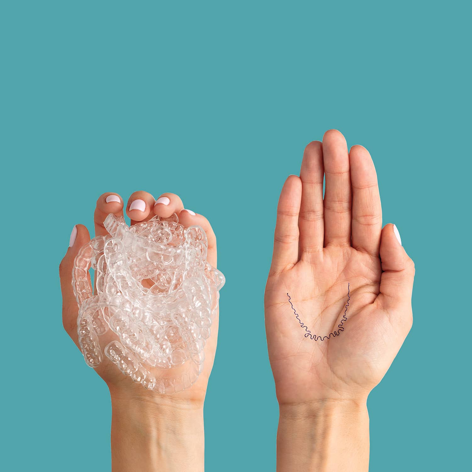 Retainers After Braces in Decatur, GA | Clinebell & Anderson