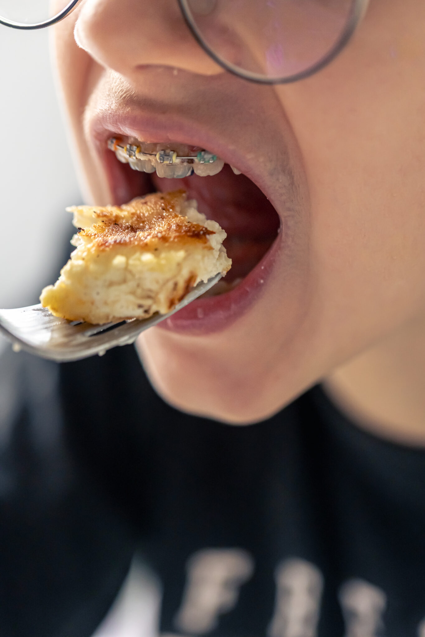 Braces-Friendly Snacks: What to Eat and What to Avoid - Clinebell ...